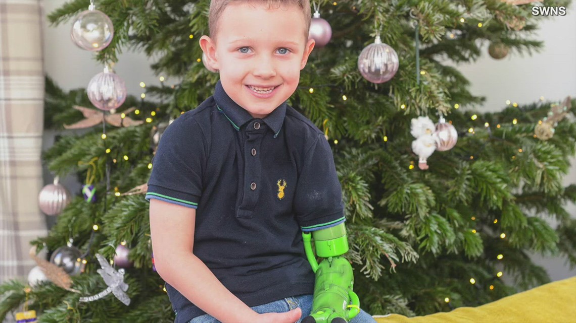 Boy, 5, born with one arm gets second one for Christmas | 13newsnow.com