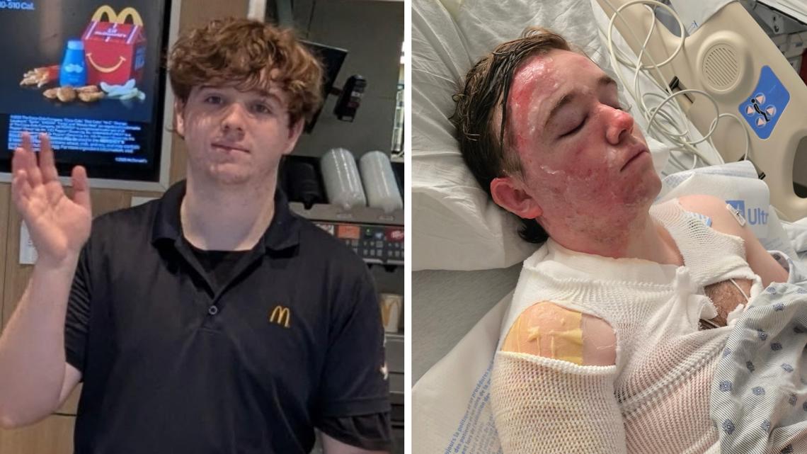 McDonald's employee shares emotional thank you after hot oil attack ...