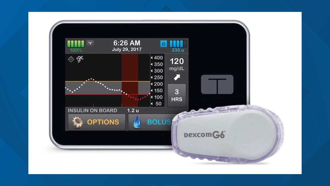 FDA approves UVA-developed artificial pancreas | 13newsnow.com