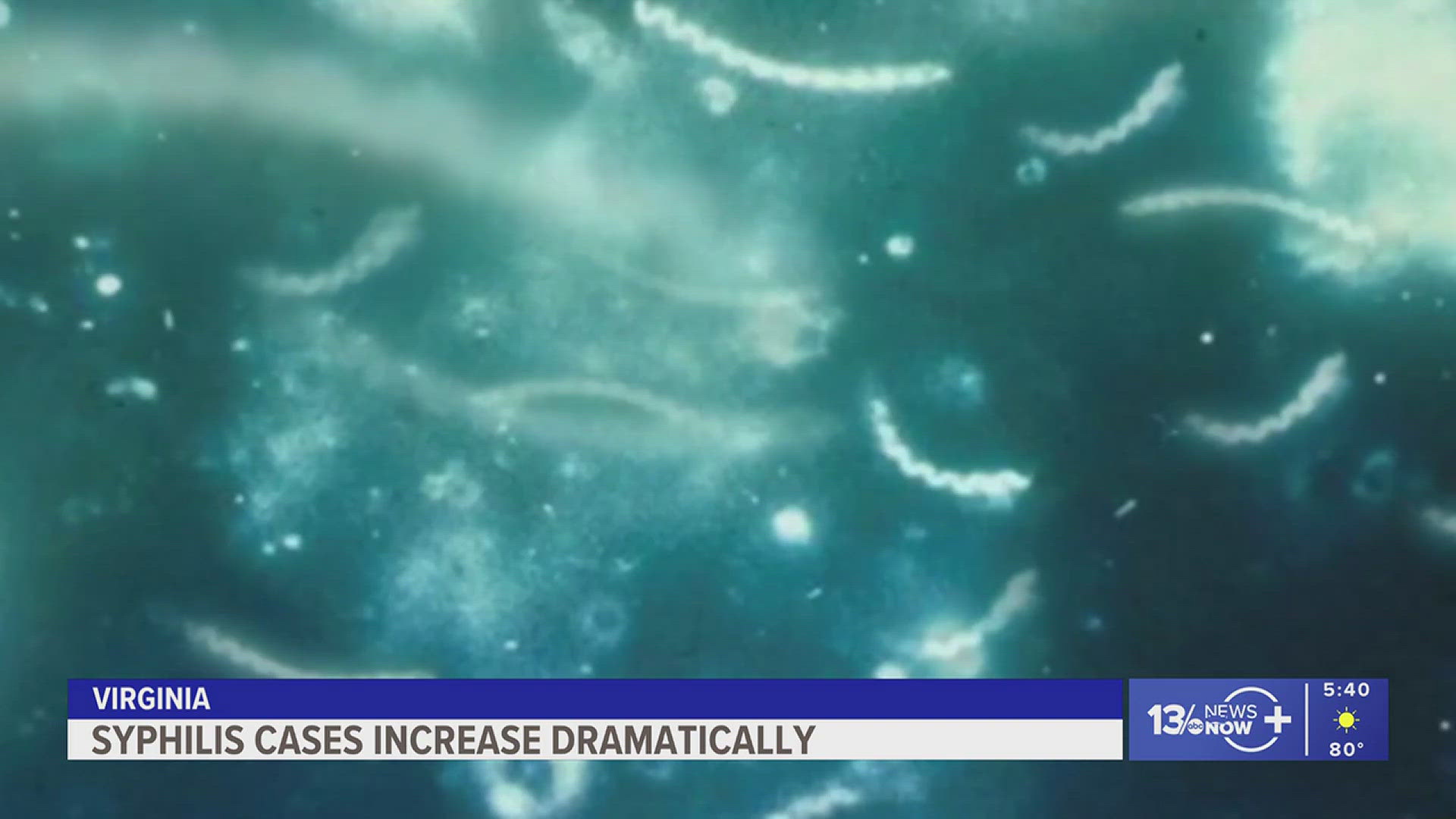 Syphilis cases rise in Virginia, impacting young women | 13newsnow.com