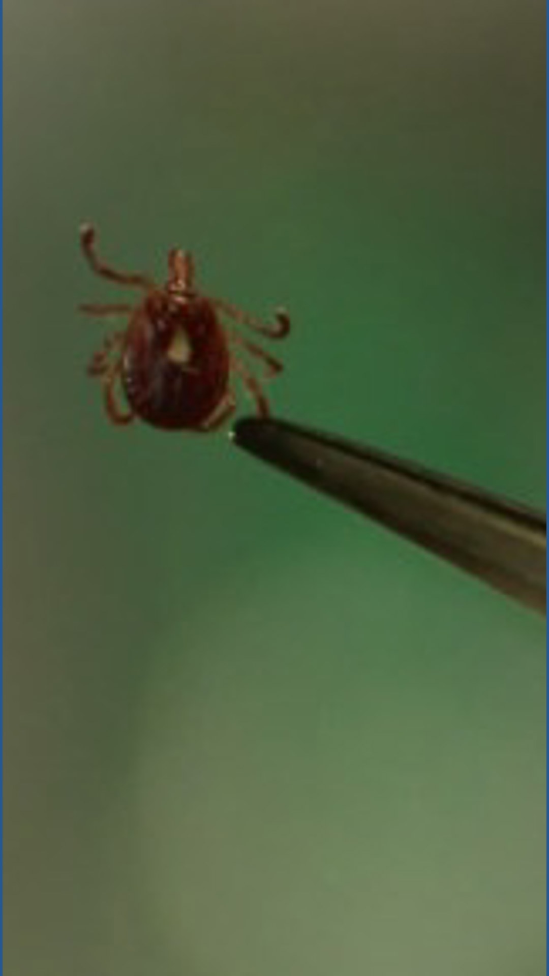 Tick bites on the rise across the nation | 13newsnow.com