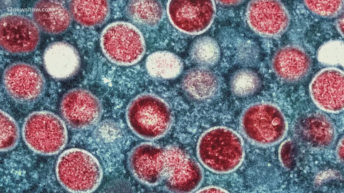First mpox death reported in Virginia | 13newsnow.com